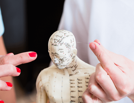 The Ultimate Guide to Dry Needling – Facts & Physio