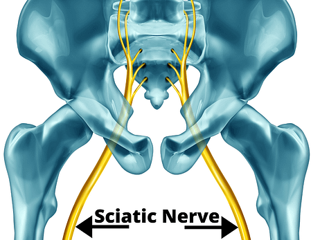 The Ultimate Guide to Dry Needling – Facts & Physio